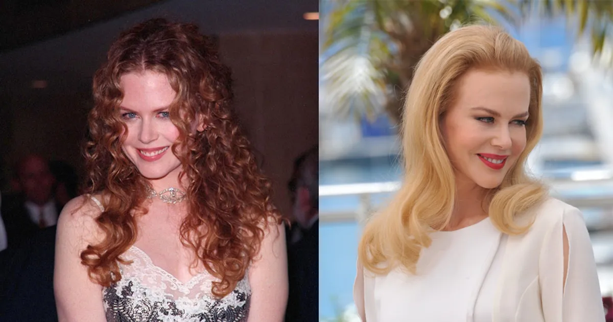 17 Celebs Who Looked Better Before Plastic Surgery - Fame10