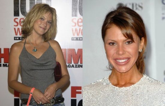 17 Celebs Who Looked Better Before Plastic Surgery - Fame10