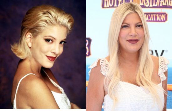 17 Celebs Who Looked Better Before Plastic Surgery - Fame10